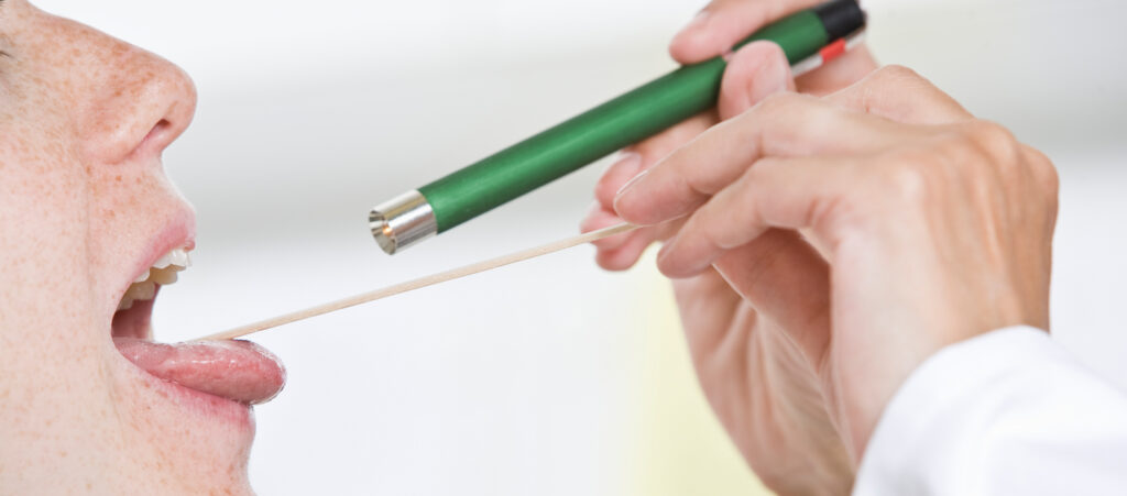 Saiba tudo sobre a remoção cirúrgica das amígdalas. | HAS